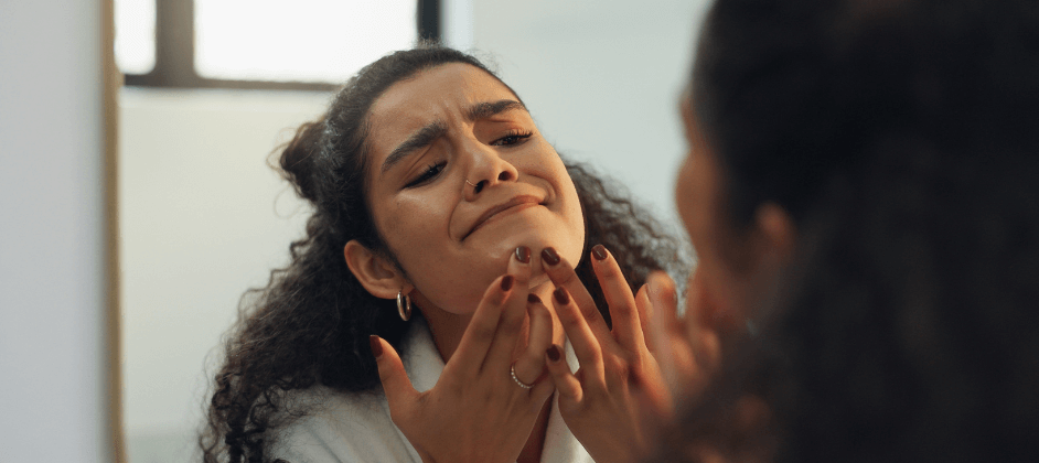 Skin Freaking Out? Here’s What To Do (Before You Panic) | South Beach Skin Lab